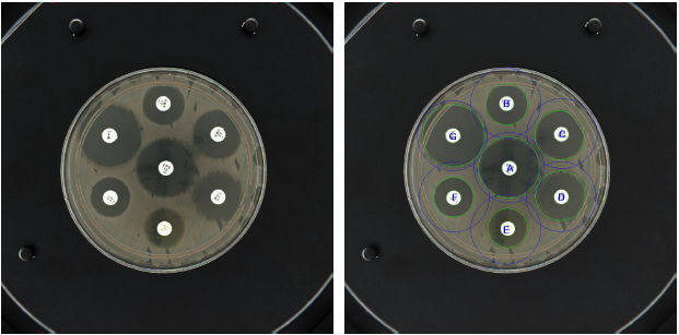 Antibiotic Susceptibility Testing - Synoptics